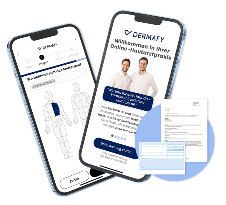 Abszess: Ursachen, Symptome & Behandlung